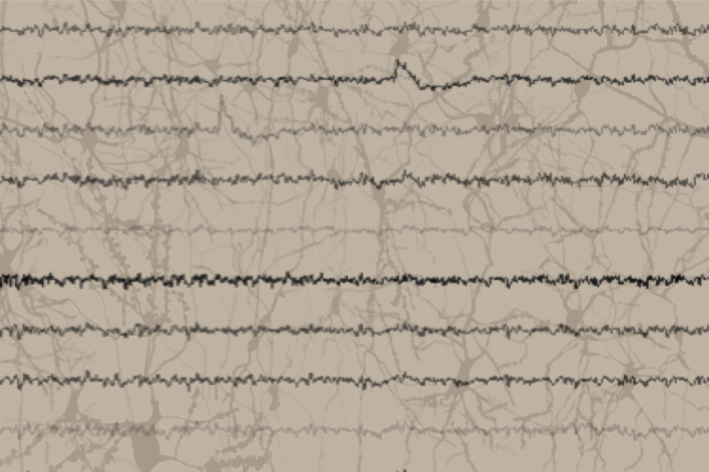 What Does the EEG Signal Measure? - Sapien Labs | Shaping the Future of ...