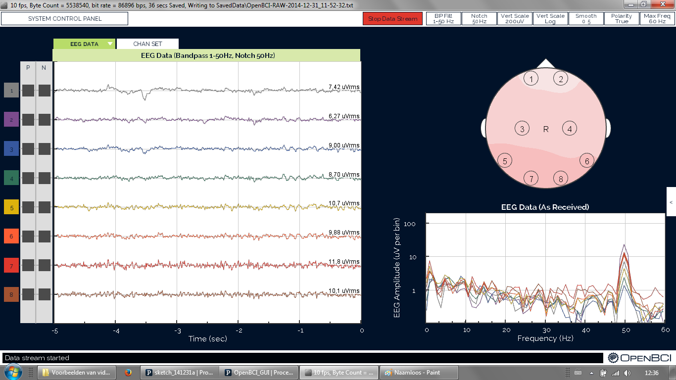 R&D with Commercially Available EEG Headsets - Sapien Labs | Shaping ...