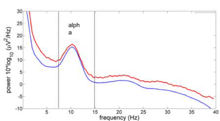 The Blue Frog in the EEG - Sapien Labs | Shaping the Future of Mind Health