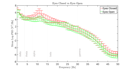 Eyes Open, Eyes Closed and Variability in the EEG - Sapien Labs ...