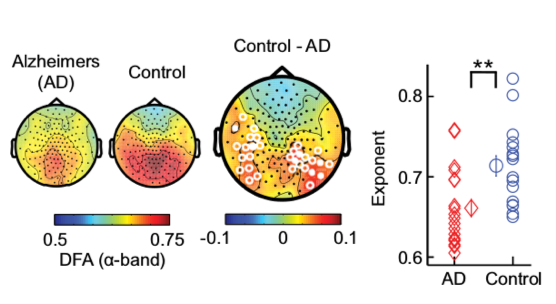Detrended Fluctuation Analysis: A Glimpse at Memory in the EEG - Sapien ...