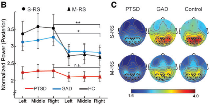 Searching for Signatures of PTSD in the EEG - Sapien Labs | Shaping the ...