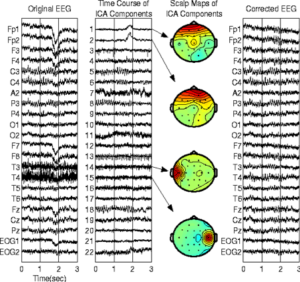 Getting Rid of Eye Blink in the EEG - Sapien Labs | Shaping the Future ...