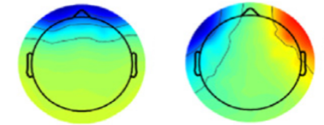 Getting Rid of Eye Blink in the EEG - Sapien Labs | Shaping the Future ...