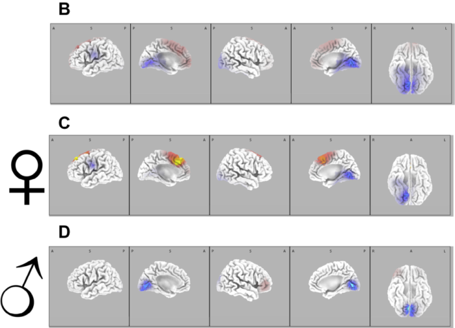Frontal Asymmetry in Depression - Sapien Labs | Shaping the Future of ...