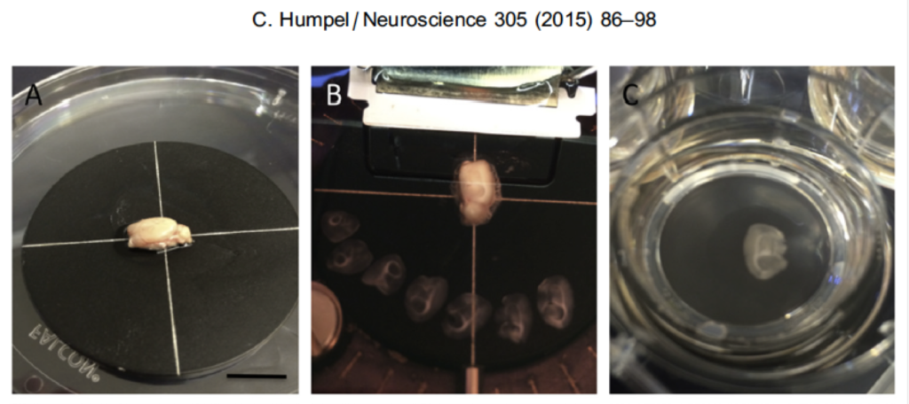 Brain in a Dish - Sapien Labs | Shaping the Future of Mind Health