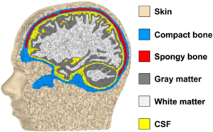 Source Localization in the EEG - Sapien Labs | Shaping the Future of ...