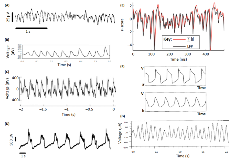 Brain Waves, Sine Waves and the Fourier Transform - Sapien Labs ...