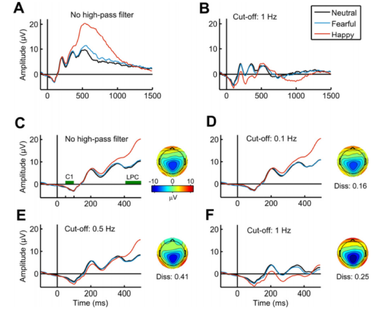 Pitfalls of Filtering the EEG Signal - Sapien Labs | Shaping the Future ...