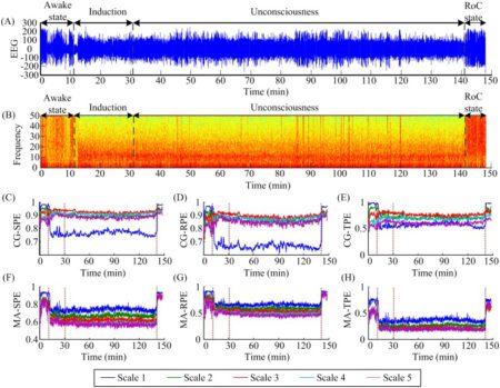 Tracking Anesthesia - Sapien Labs | Shaping the Future of Mind Health