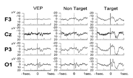 Applications of Wavelets in EEG - Sapien Labs | Shaping the Future of ...