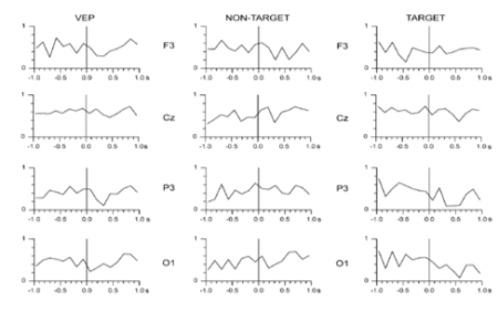 Applications of Wavelets in EEG - Sapien Labs | Shaping the Future of Mind Health