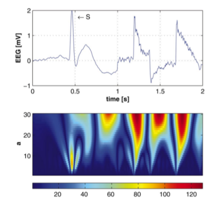 Applications of Wavelets in EEG - Sapien Labs | Shaping the Future of Mind Health