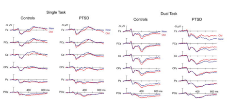 PTSD and Memory Deficits: Which Causes the Other? - Sapien Labs ...