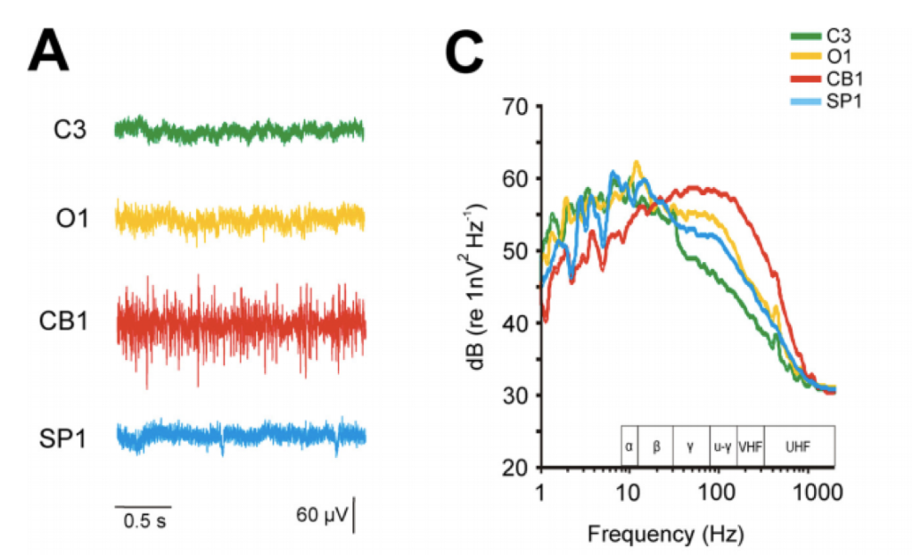 Can you measure EEG in the Cerebellum? - Sapien Labs | Shaping the ...