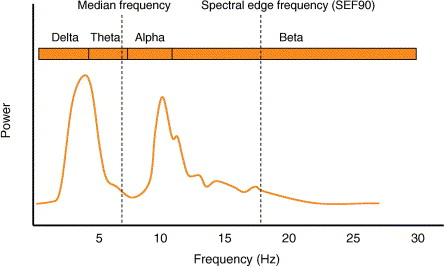 EEG Approaches to Measuring Depth of Anesthesia - Sapien Labs | Shaping ...