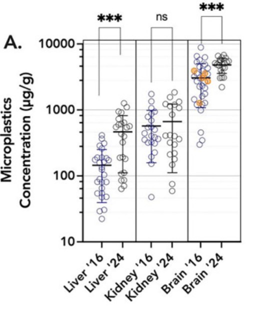 There are plastics lodged in the human brain. How do they get there ...